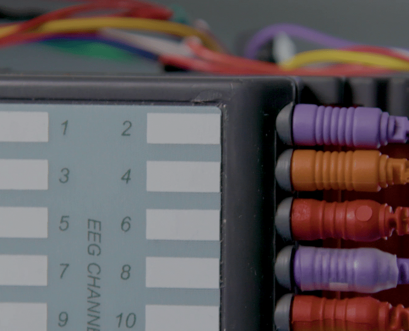 EEG Machine Archives - Lifelines Neuro